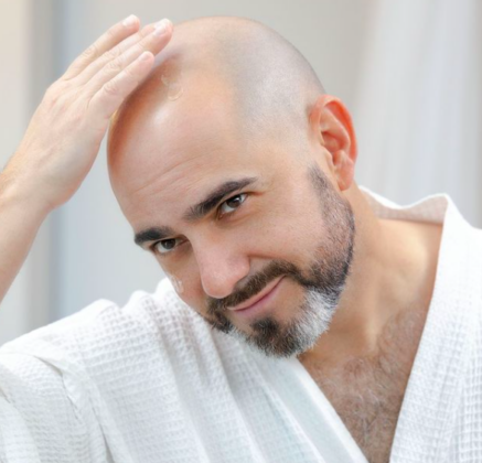 Bald Before & After: MANTL CEO On His Balding Journey