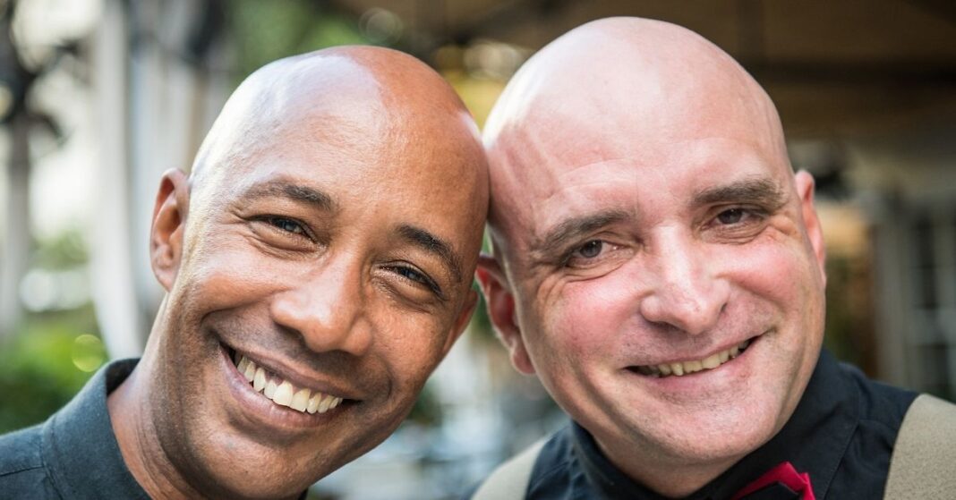 15 of The Best Hairstyles For Balding Men | The Bald Brothers