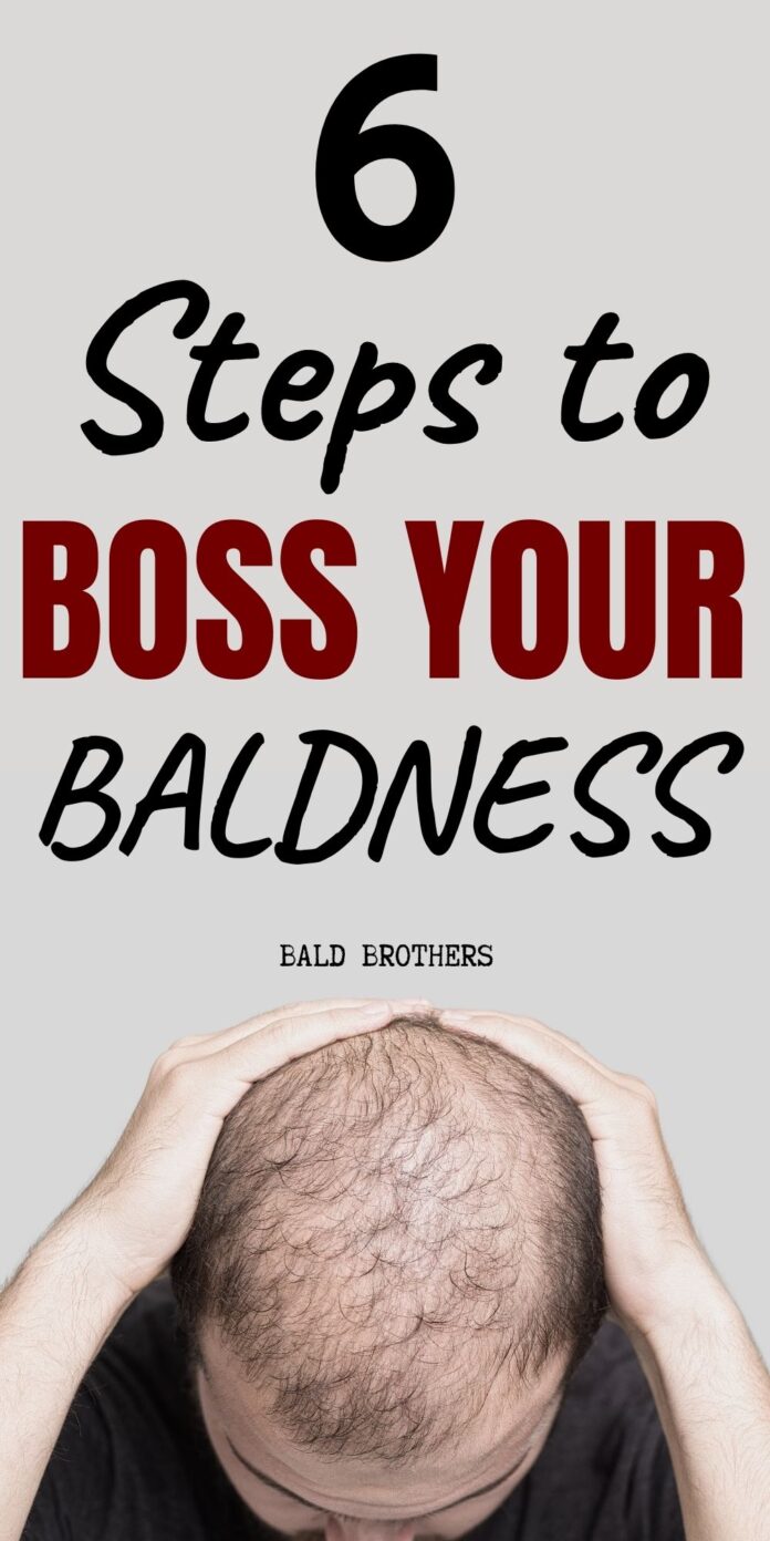Taking Ownership - Boss Your Baldness The Right Way