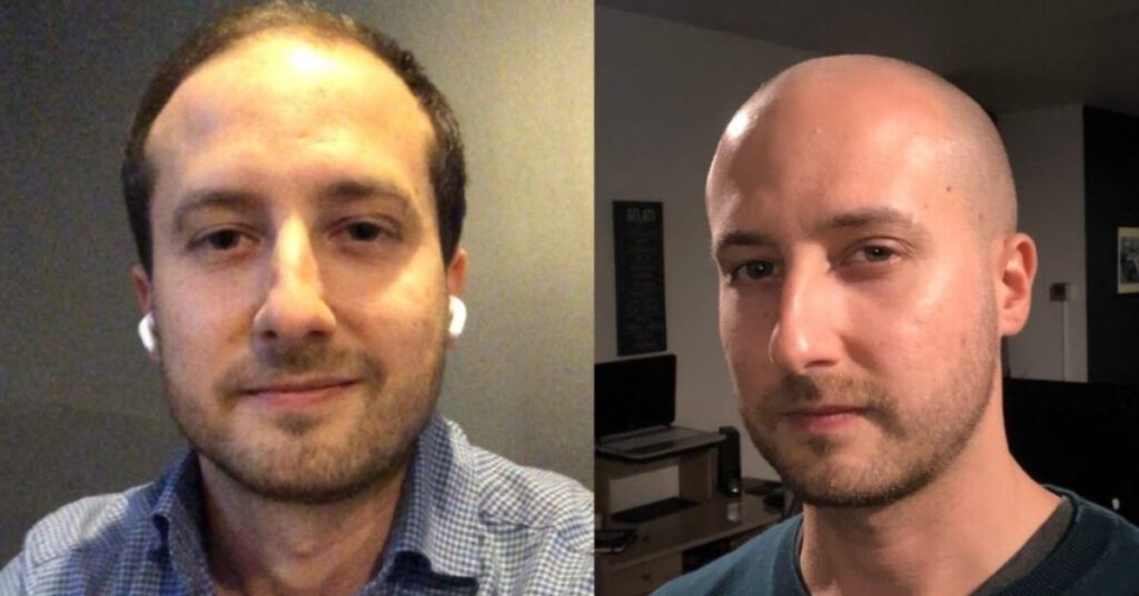 All Balding Tips by The Bald Brothers