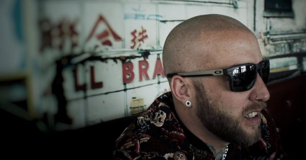 Scalp Care: How To Prevent Getting A Dry, Flaky Scalp - The Bald Brothers
